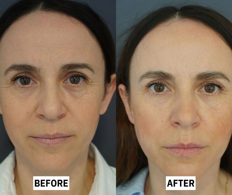 Das beste Retinol Serum 2025: Diese Wirkstoffe sind wichtig – DOC ...